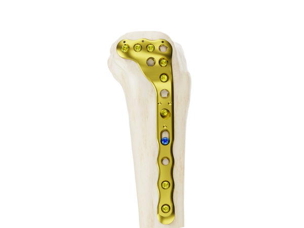 Affinity Tibia Proximal – App Pedidos Sampedro