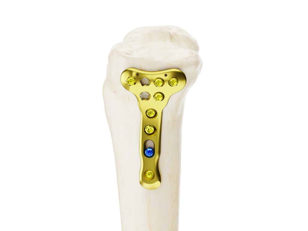 Affinity Tibia Proximal – App Pedidos Sampedro